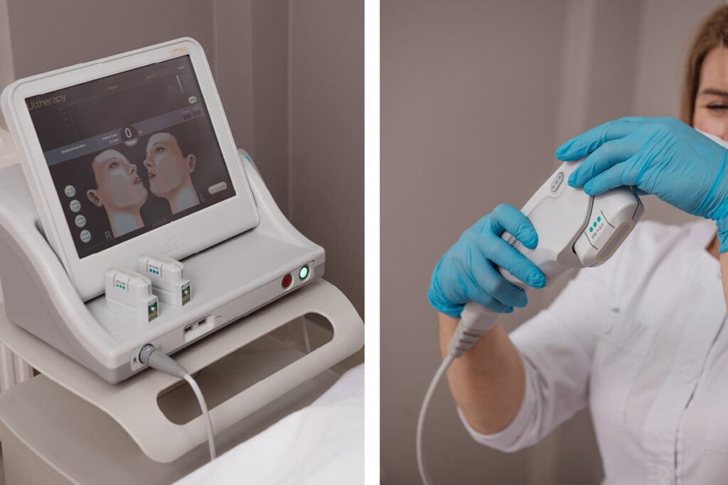 ULTHERA® SYSTEM – SMAS-лифтинг без инъекций и пластических операций!